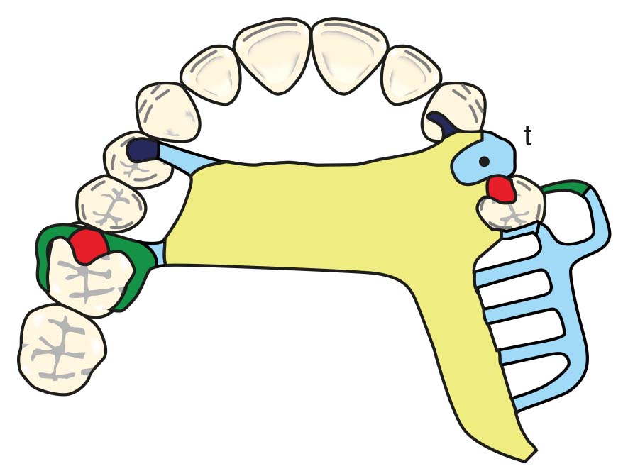 Determining the denture base and artificial teeth – A Guide to ...